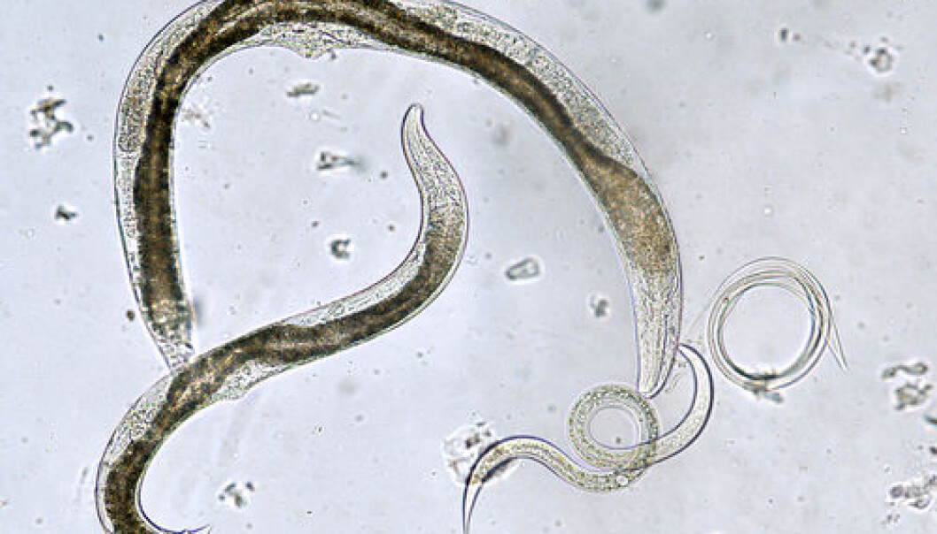 Dead parasites in your sushi can trigger allergic reaction