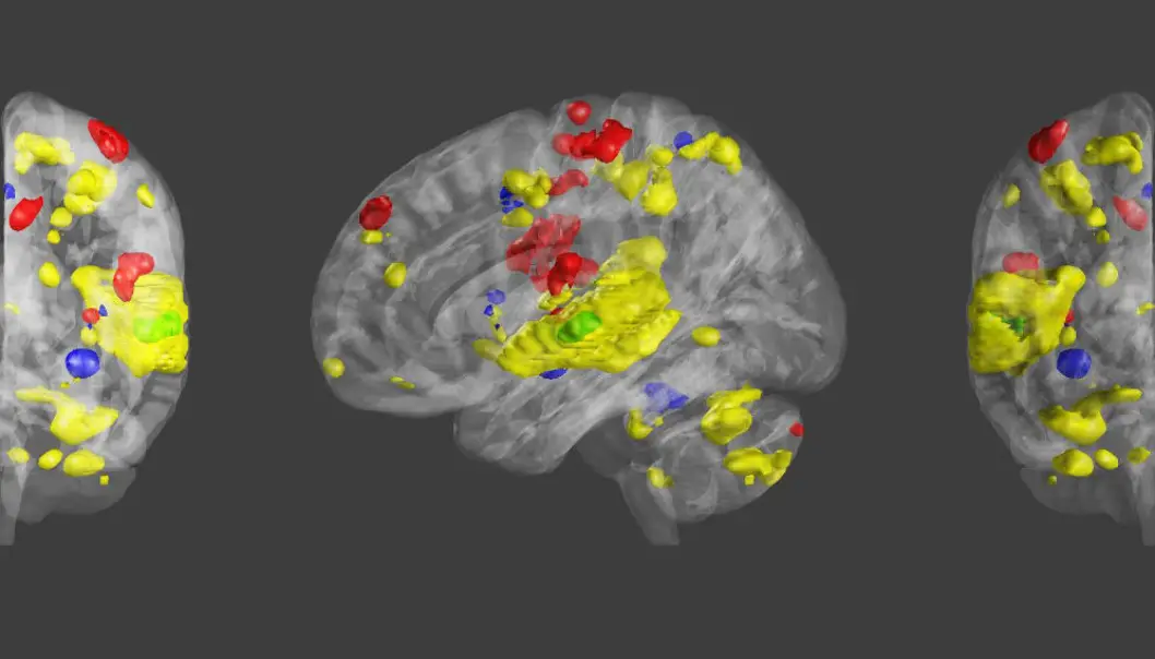 How music touches the brain